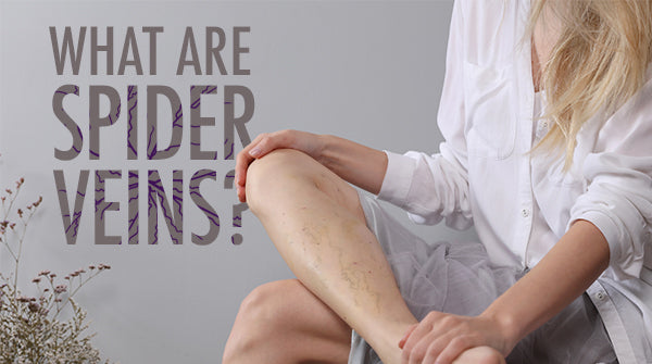What Are Spider Veins? - NaturesPlus